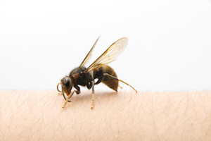Stinging Insects 101: Essential Information and Safety Tips