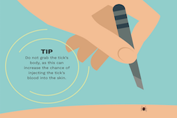 How To Remove a Tick: Tips & Advice for Removing a Tick